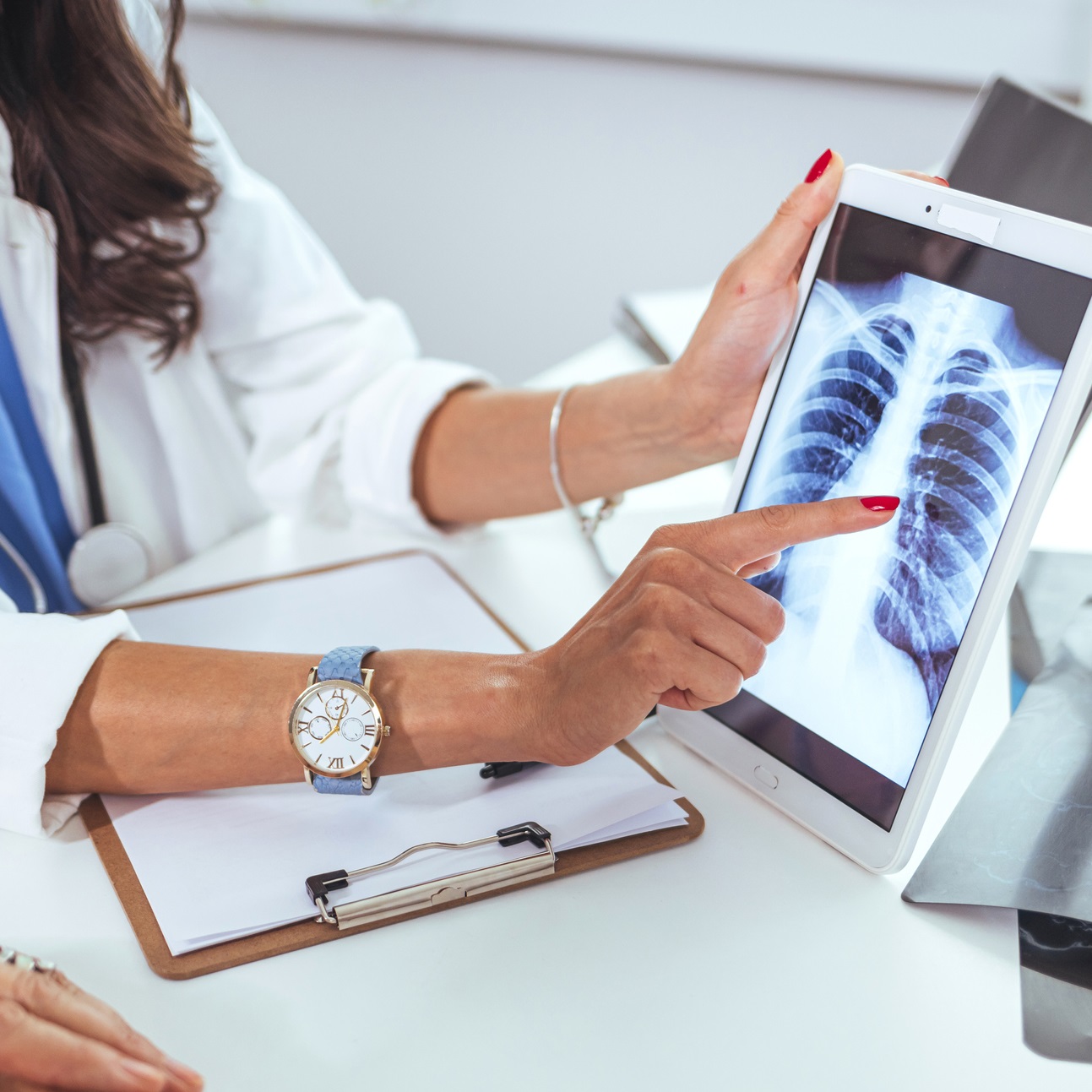 Hendrick offers early detection and treatment in fight against lung cancer